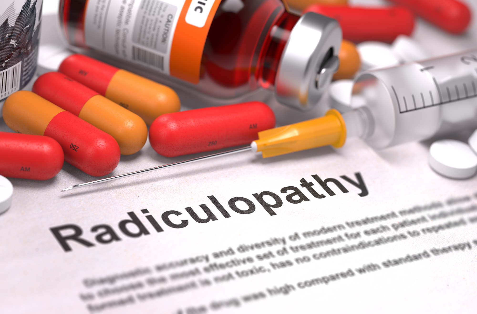 What is Radiculopathy? | Radiculopathy Causes, Treatment