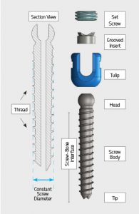 Solid Screw Fixation by Pedicle Screw-Based ProMIS™ System Implants