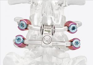 Spine Surgery Implants to Cure Spinal Conditions | Premia Spine