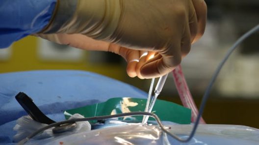 What Are the Symptoms of Nerve Damage After Back Surgery?